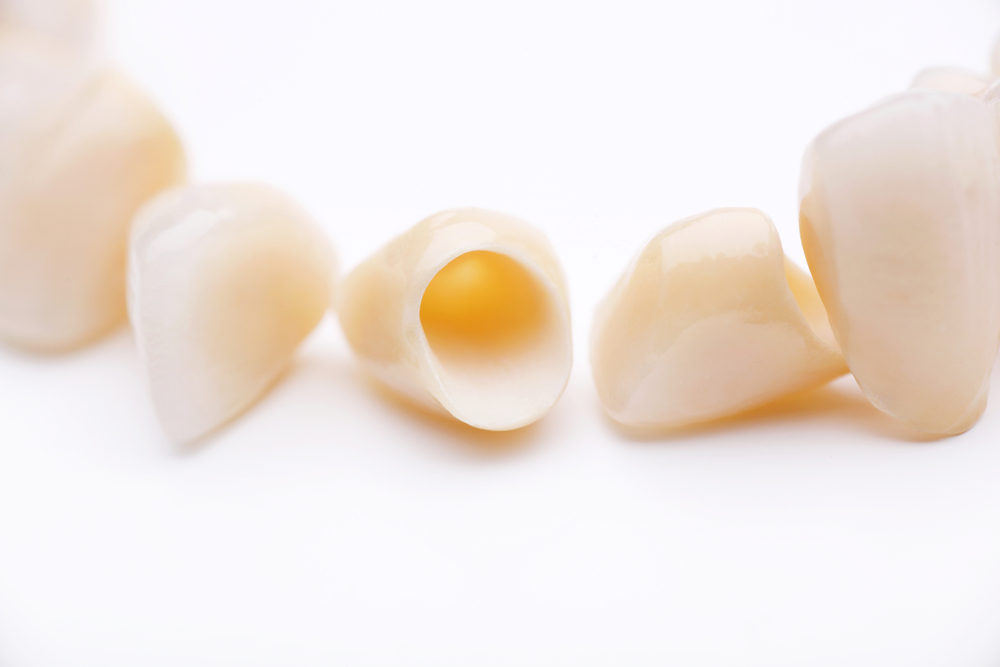 Crowns - Dr. Chris C. Loukaitis | D.D.S., M.S., | D.D.S. Prosthodontist