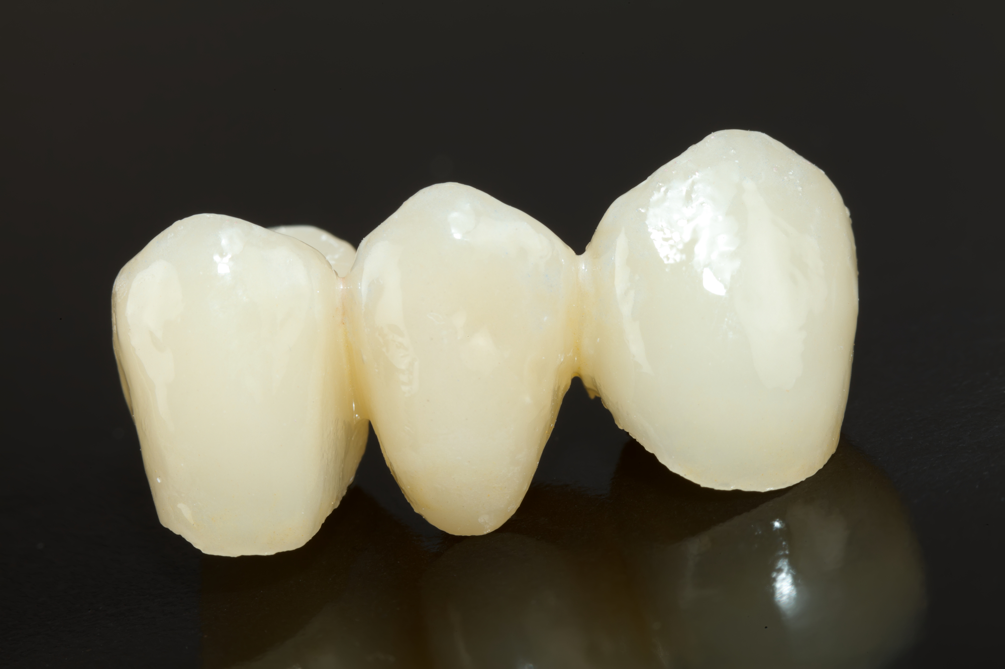 Bridges - Dr. Chris C. Loukaitis | D.D.S., M.S., | D.D.S. Prosthodontist