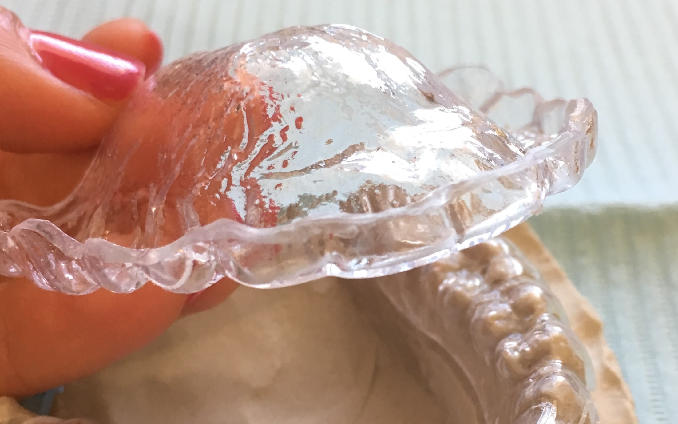 Occlusal Guards - Dr. Chris C. Loukaitis | D.D.S., M.S., | D.D.S ...